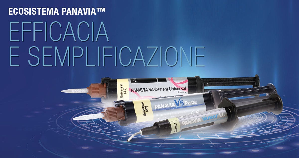 Cementi PANAVIA: tutte le esigenze di cementazione sono soddisfatte