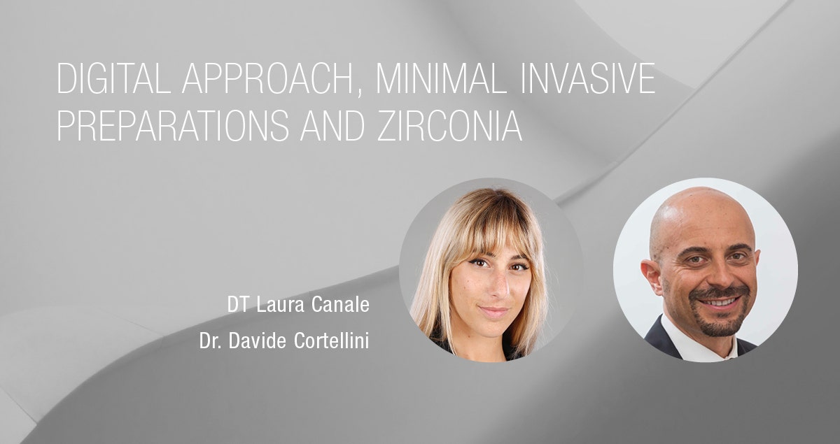 Key factors for success in prosthodontics