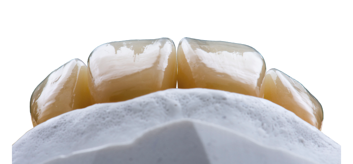 Enhance Your Monolithic Restorations with CERABIEN™ ZR FC Paste Stain