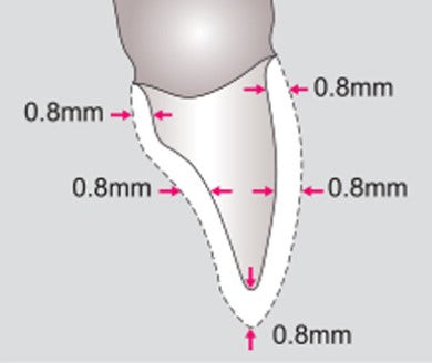 KATANA Zirconia STML | mulit-layered disc | translucency and strength