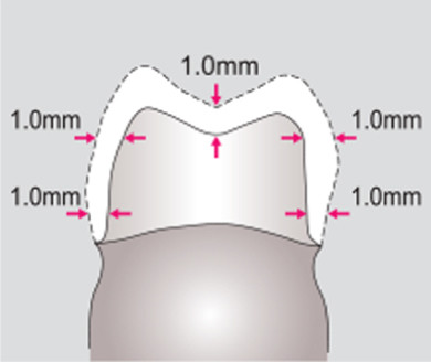 Noritake KATANA Zirconia Block STML