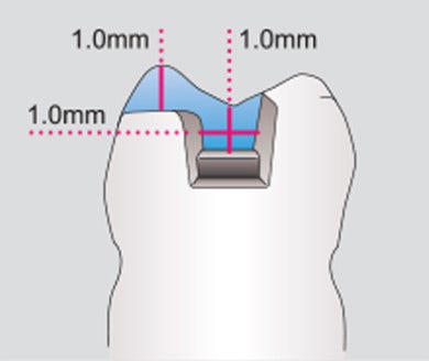 KATANA Zirconia UTML | multi-layered disc | high translucency levels