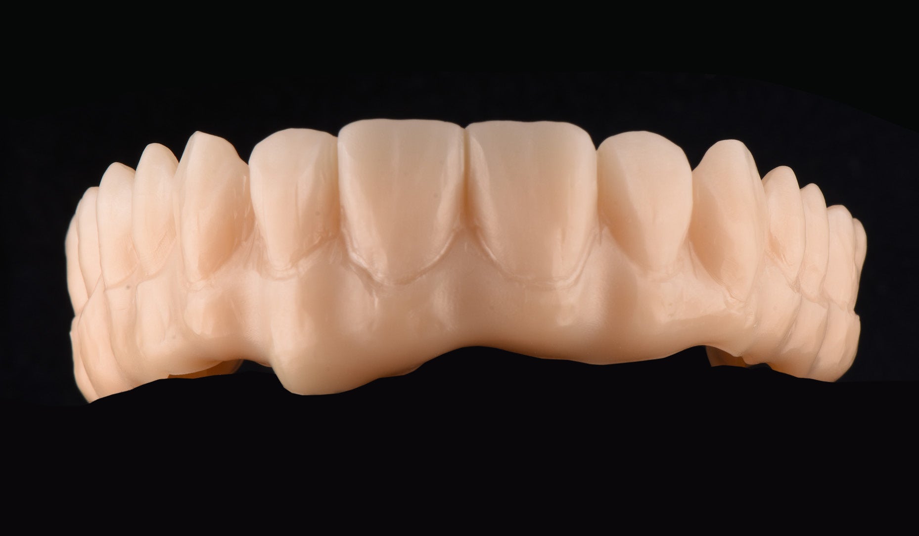 Micro-Layering for Zirconia Implant Prostheses | Case Study