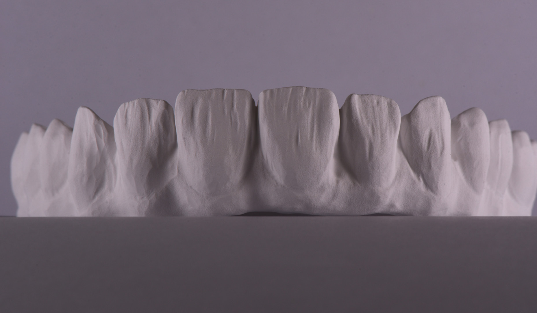 Micro-Layering for Implant Restorations with CERABIEN MiLai